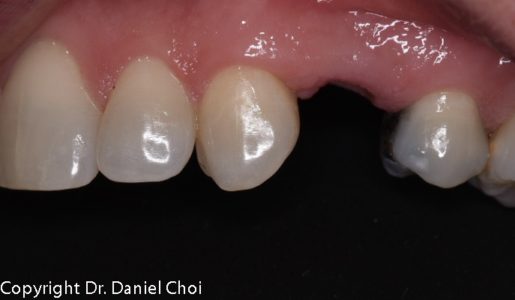 The Grapevine Dentist - Home Page