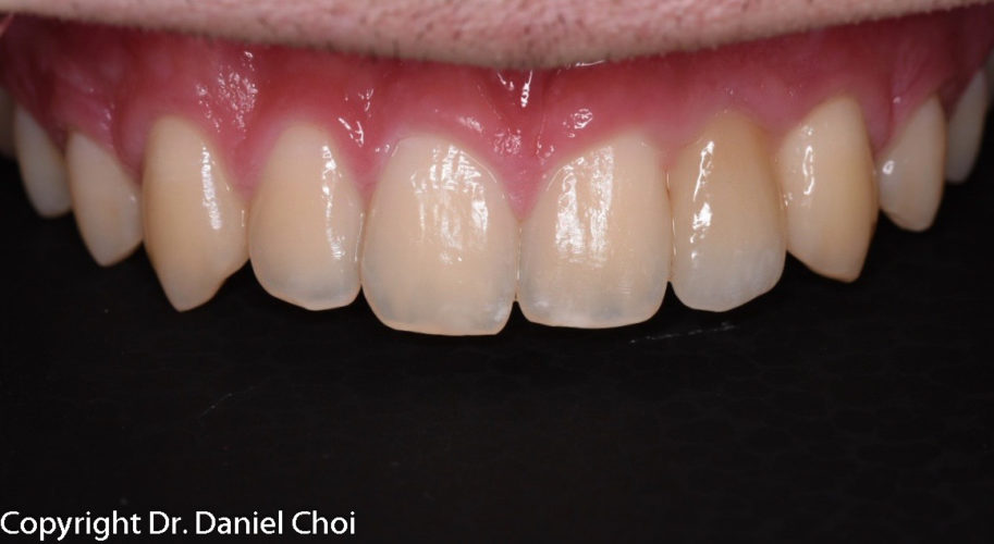 The Grapevine Dentist - Home Page