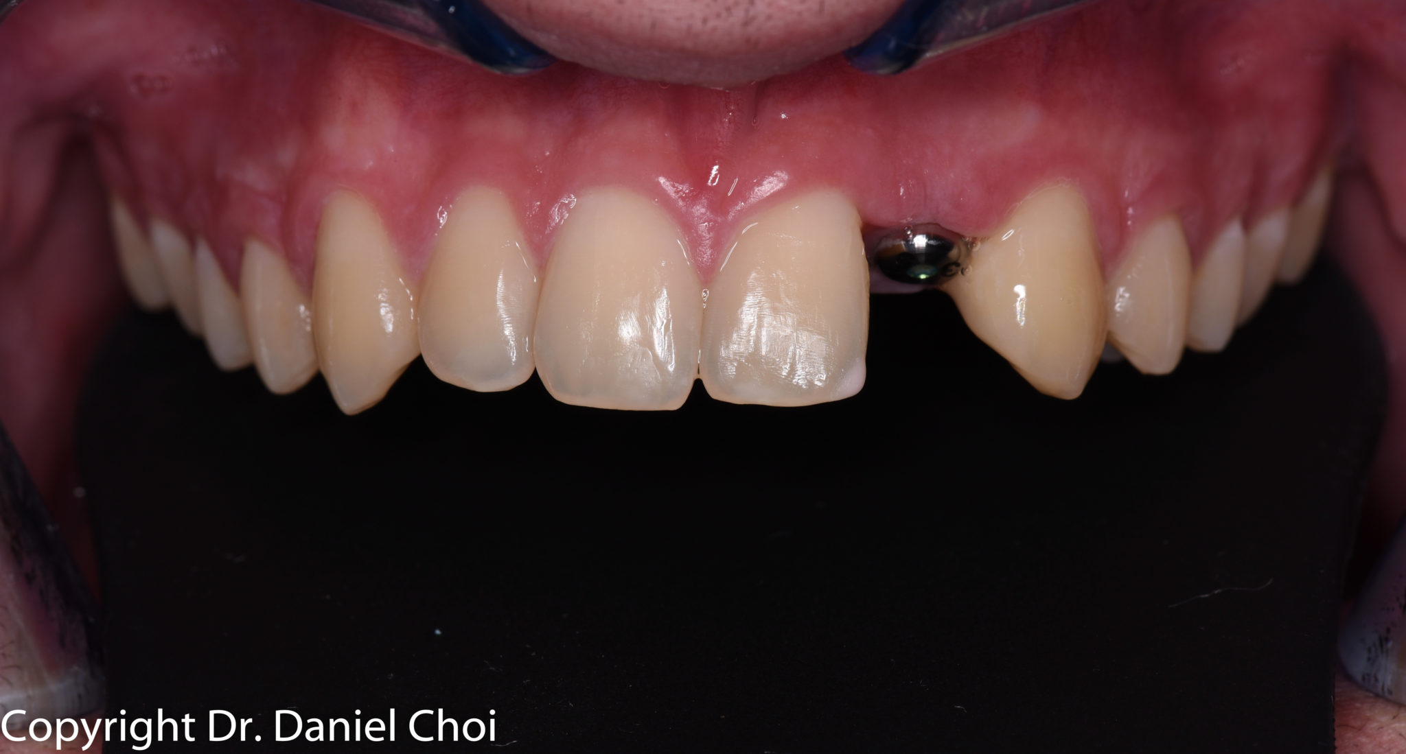 The Grapevine Dentist - Home Page